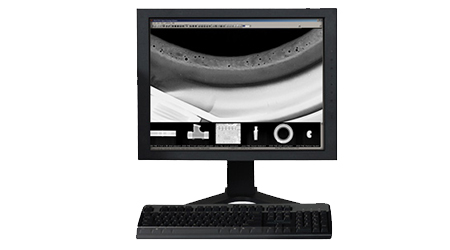 Carestream Health Emea - OneStopNDT